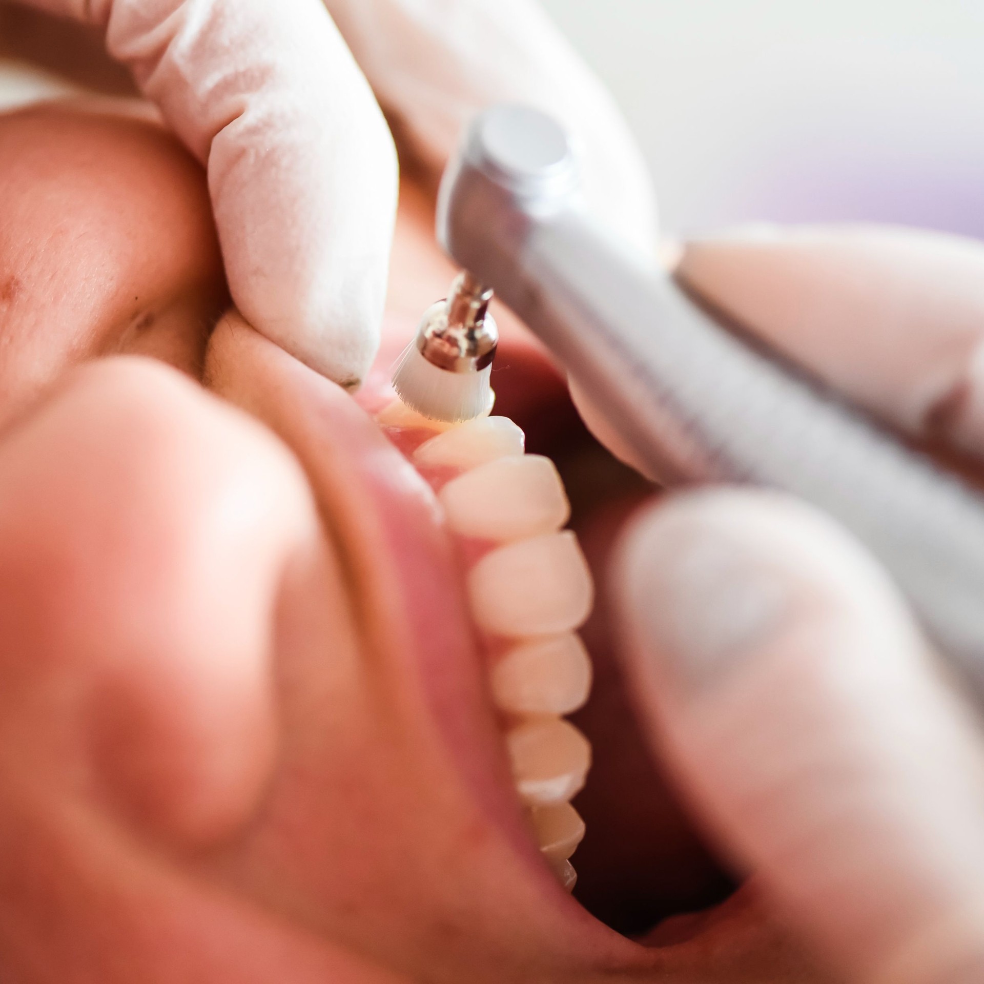 Advanced General Dentistry - Serenity Advanced Dentistry - Cedar Hill, TX