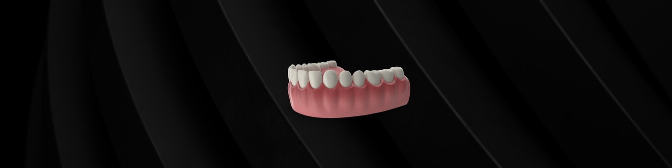 Same Day Dentures Services - Serenity Advanced Dentistry - Cedar Hill, TX